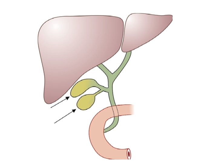 gall bladder The gallbladder is a pearshaped sac