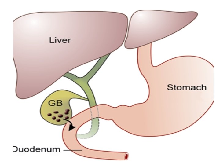 gall bladder The gallbladder is a pearshaped sac