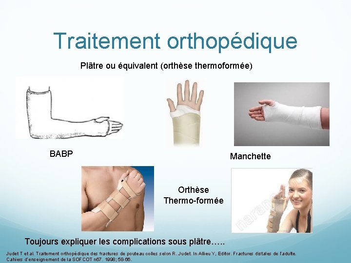Fractures de lextrmit distale du radius de la