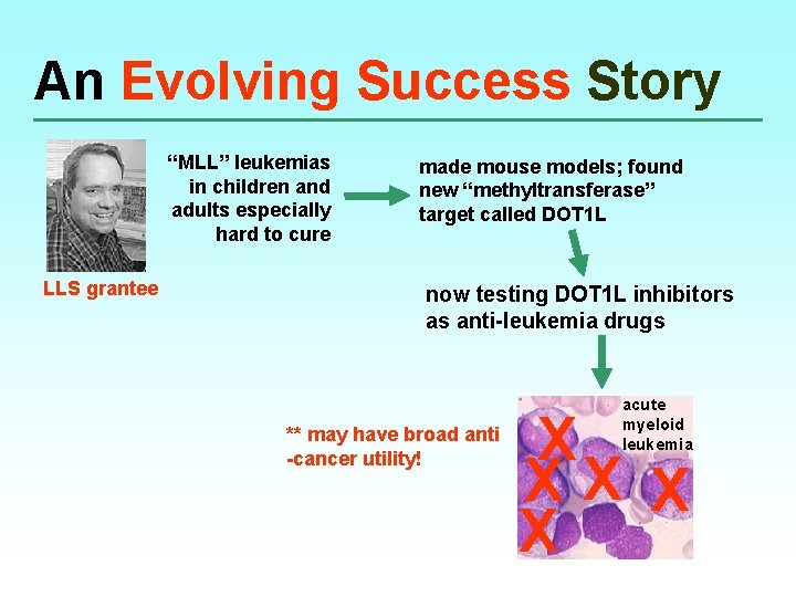 LLS Research Success Stories Deborah Banker Ph D