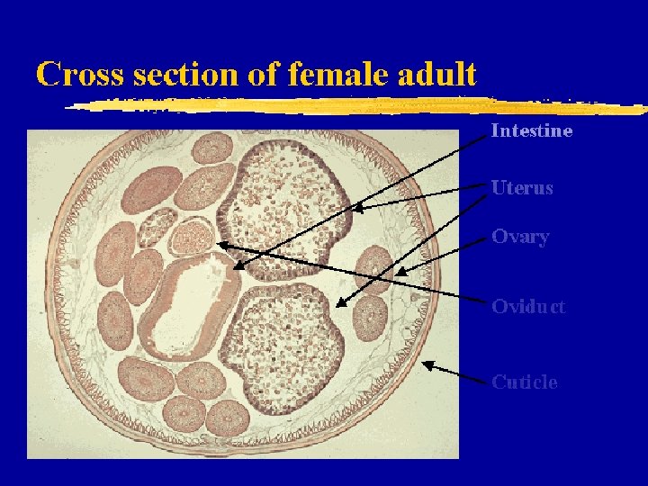 Ascaris lumbricoides Ascariasis Synonym Large round worm of
