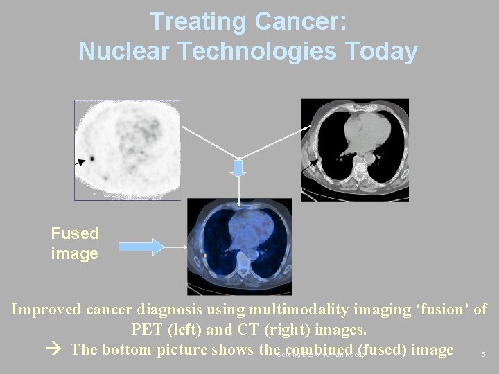 Atoms for Health Prof Dr Werner Burkart Skolkovo