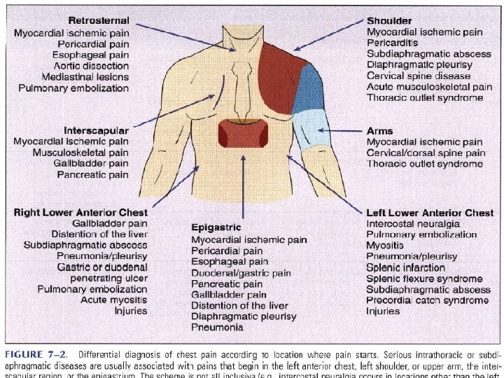 Chest Pain Or Discomfort Etiology 1 Cardiac 2