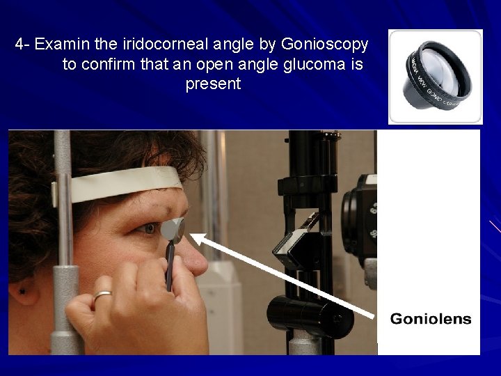Glaucoma Glaucomas are group of diseases causing damage
