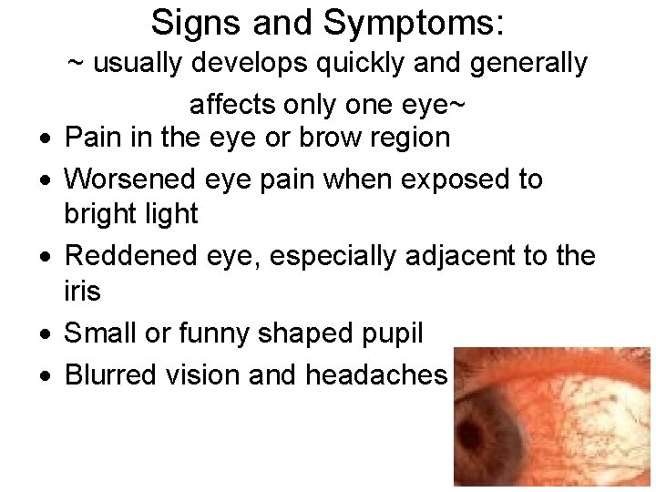 Iritis By Becky and Terryn Causes of Iritis