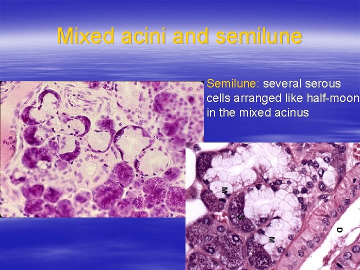 The Digestive System Exocrine glandwith duct Constituents of