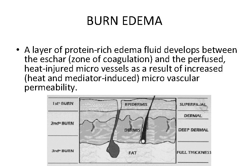 BURNS Mechanisms of Injury and Biomechanics Energy Agents