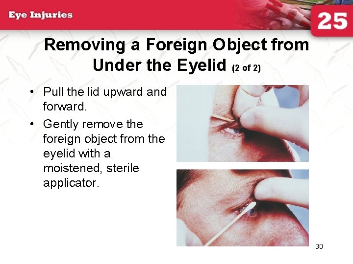 25 Eye Injuries 1 Cognitive Objectives 1 of