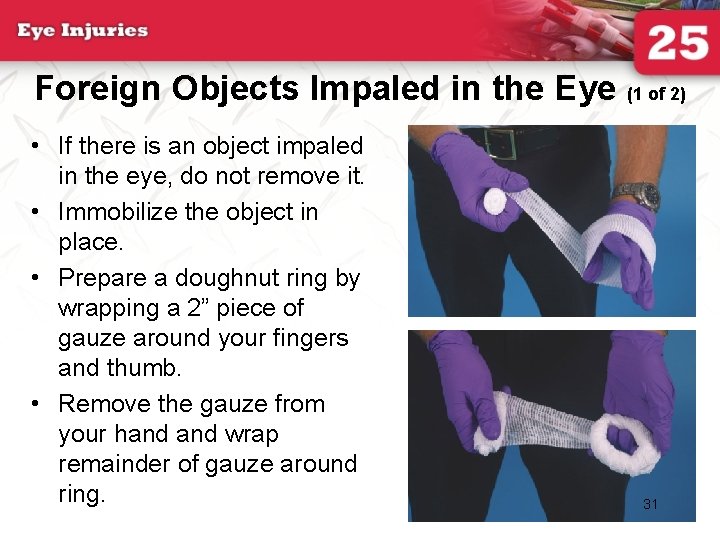 25 Eye Injuries 1 Cognitive Objectives 1 of
