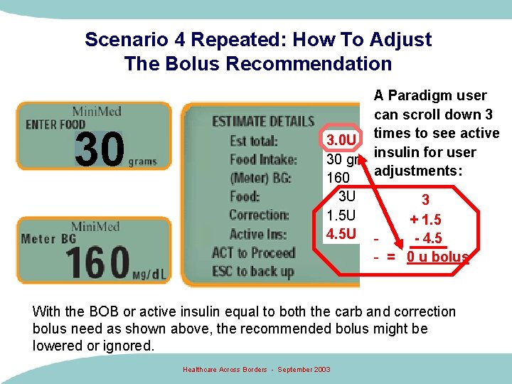 Insulin Pumps Give Different Bolus Recommendations When BOB