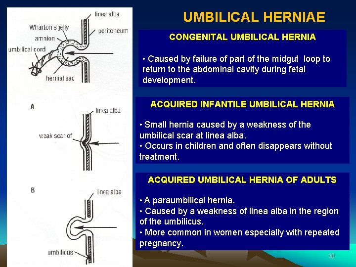 Anterolateral Abdominal Wall And By Prof Saeed Abuel