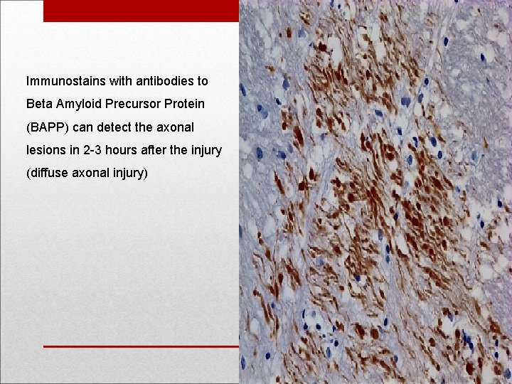 Cellular aspects of Nervous System Injury Pathology of