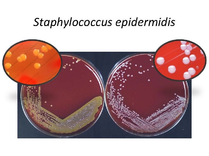 STAPHYLOCOCCUS Skin upper respiratory tract lower digestive system