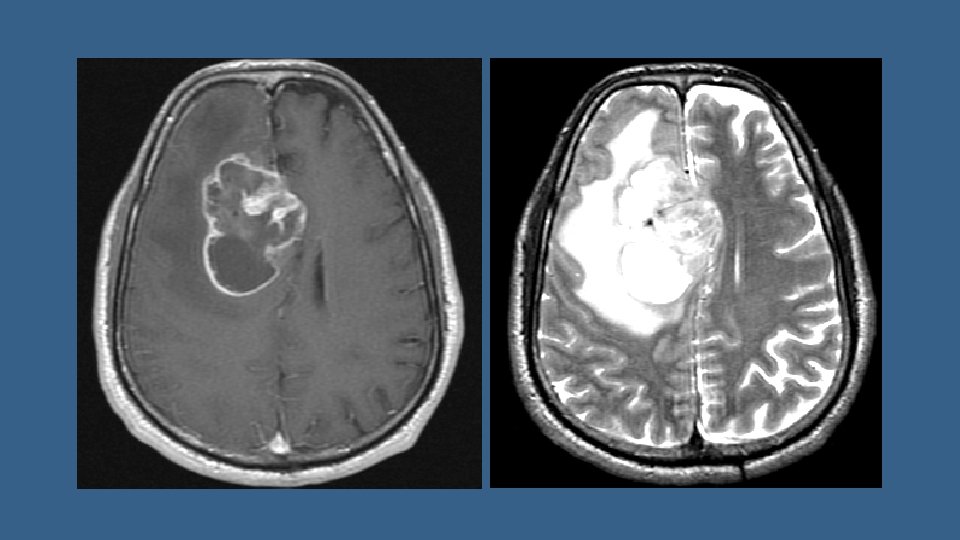 Neuroradiology interactive lecture 366 RAD Radiology Prof Ibrahim