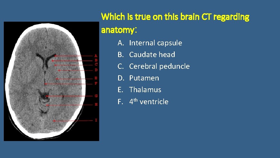 Neuroradiology interactive lecture 366 RAD Radiology Prof Ibrahim