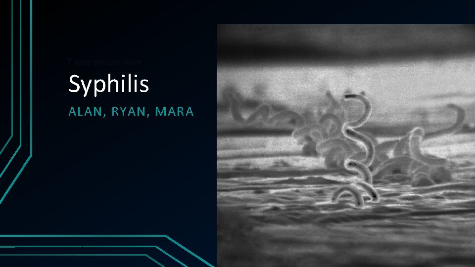 These people have Syphilis ALAN RYAN MARA History