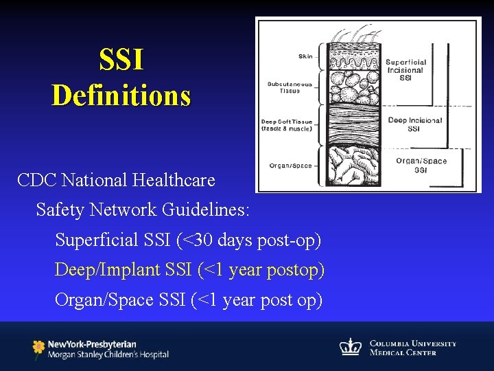 Management of Implant Related Infections Growing Rods Michael