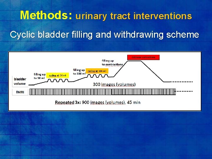 Brain activation in response to urinary bladder filling