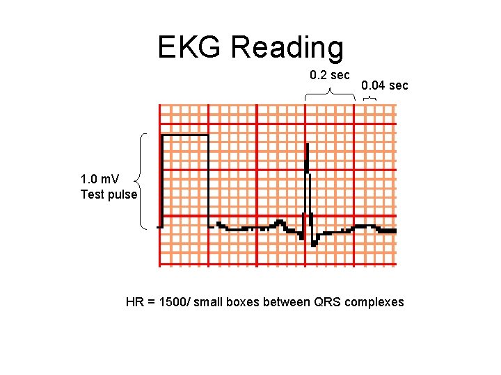 ECG 1 BIPOLAR LEADS I II III 2