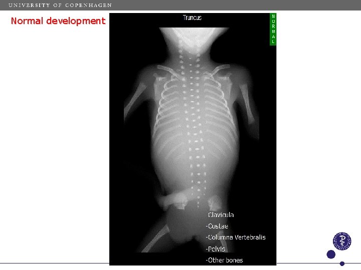 Normal and pathological development of the human skeleton