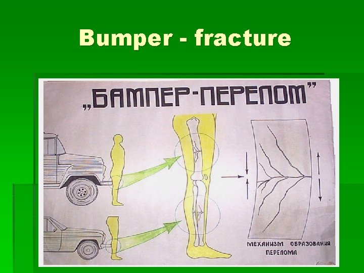 Vehicular trum Lecture 5 Assciativeprofessor Valentin V Franchuk