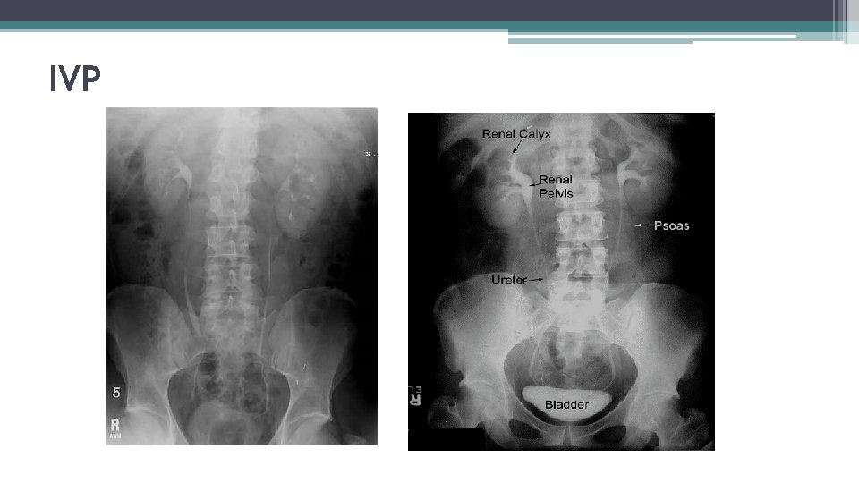 Radiology Renal System Objectives Modality used for assessment