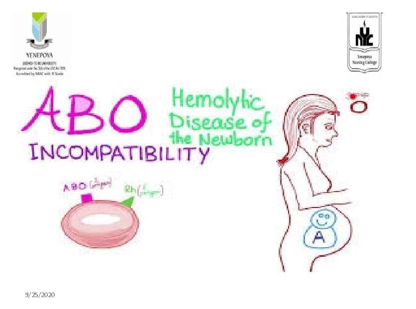 Common neonatal disorders 9252020 PREPARED BY Mrs Benazeera