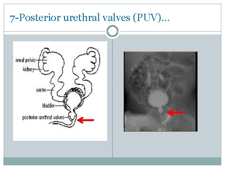 Pediatric urinary disorders DR HAMDAN ALHAZMI Objectives Understand