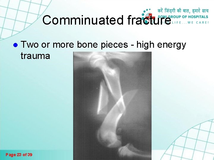 Fractures and Bone Healing Page 1 of 39