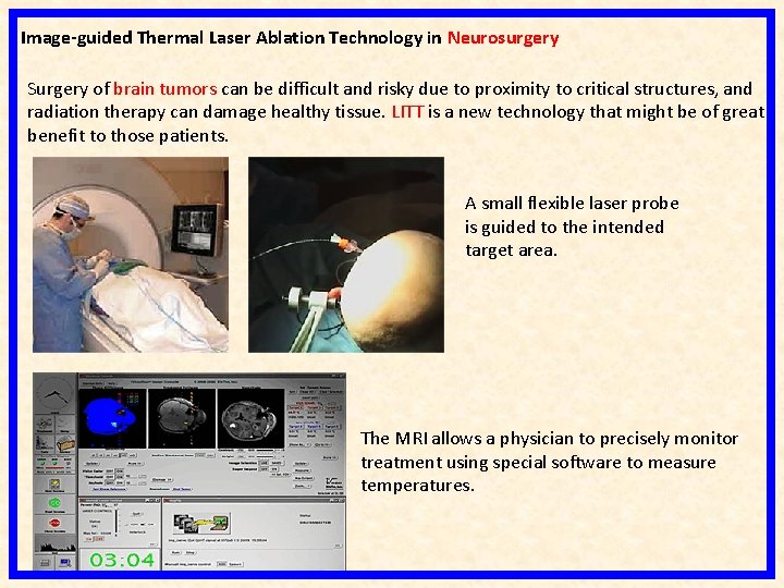 MEDICAL LASER SYSTEMS Assist Prof Dr Lutfi Ghulam