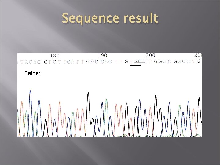 A NOVEL MUTATION IN THE AVPR 2 GENE