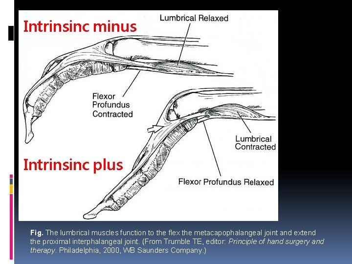INJURIES AND DISEASES OF HAND WRIST SuYang Hwa