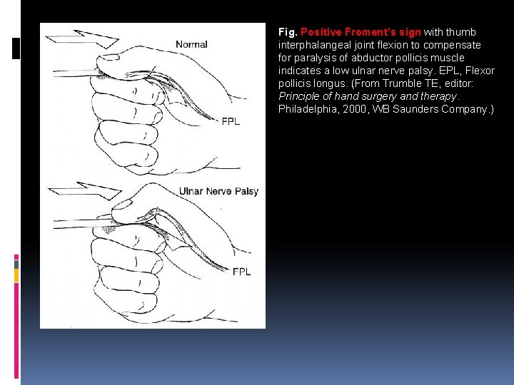 INJURIES AND DISEASES OF HAND WRIST SuYang Hwa