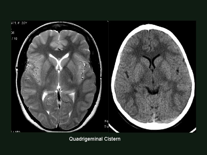 BRAIN IMAGING CT MRI Mamdouh Mahfouz MD Professor