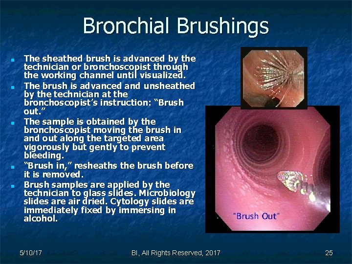 Fundamentals of Bronchoscopy EQUIPMENT www Bronchoscopy org 51017