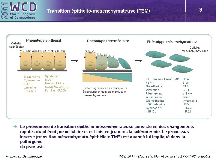 1 Histologie Vers une classification gntique des mlanomes