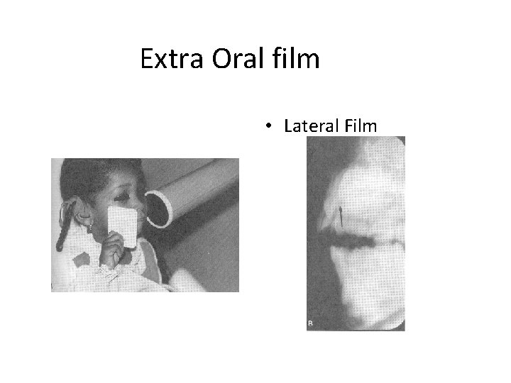 Radiographic Assessment of the Pediatric Patient Special considerations