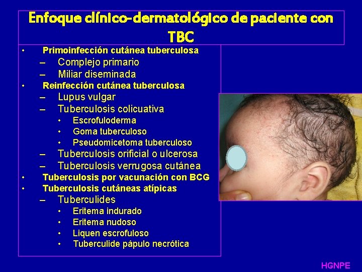 Enfoque clnicodermatolgico de paciente con TBC Prof Dra