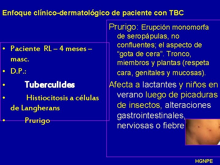 Enfoque clnicodermatolgico de paciente con TBC Prof Dra