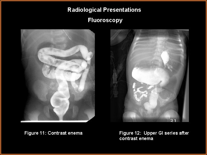 Radiological Category Pediatric Radiology Principal Modality 1 Ultrasound