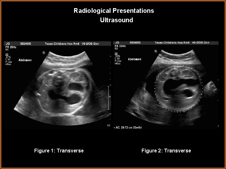 Radiological Category Pediatric Radiology Principal Modality 1 Ultrasound