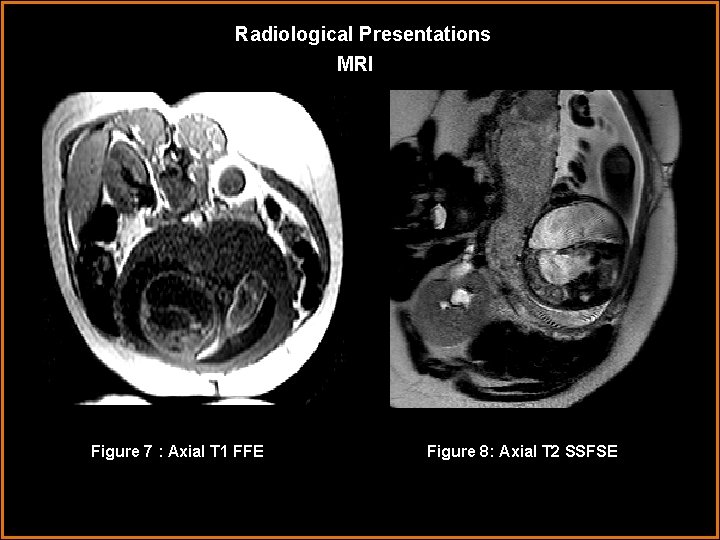 Radiological Category Pediatric Radiology Principal Modality 1 Ultrasound