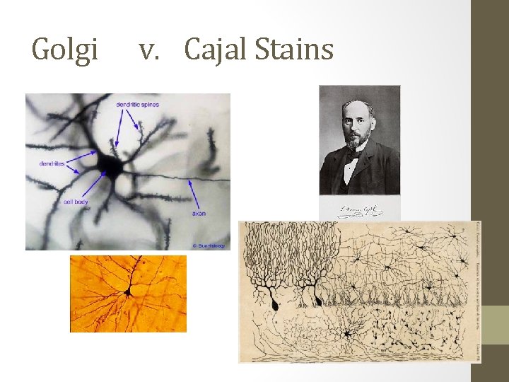 Central Nervous System Phineas Gage http www nejm