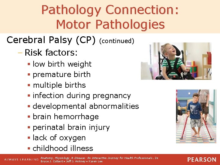 Pathology Connection Motor Pathologies Cerebral Palsy CP Permanent
