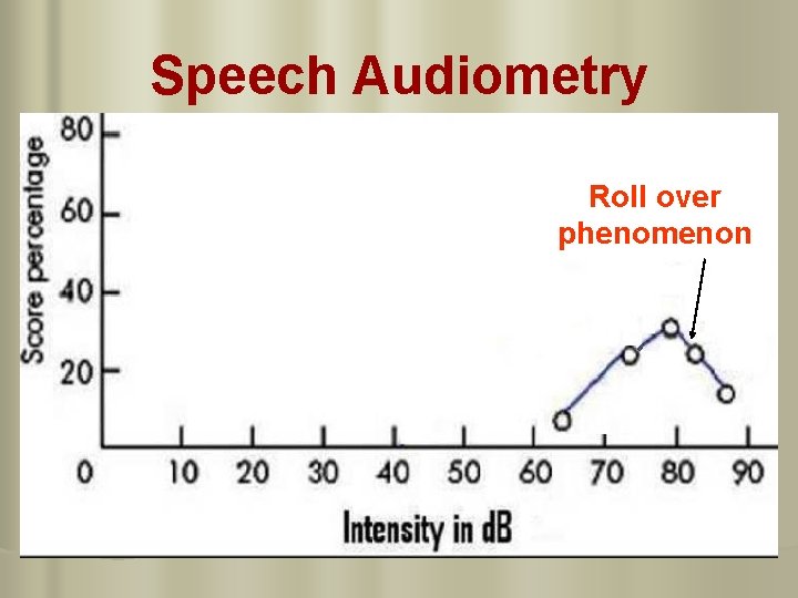 Acoustic Neuroma Introduction A K A vestibular schwannoma