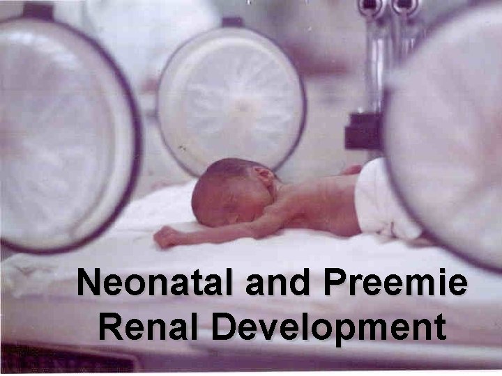 Neonatal and Preemie Renal Development 4 Practical Questions