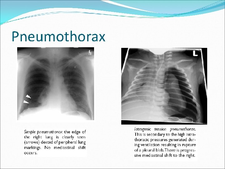 ABCs Evaluation of Trauma Patient By Dr Mahmoud