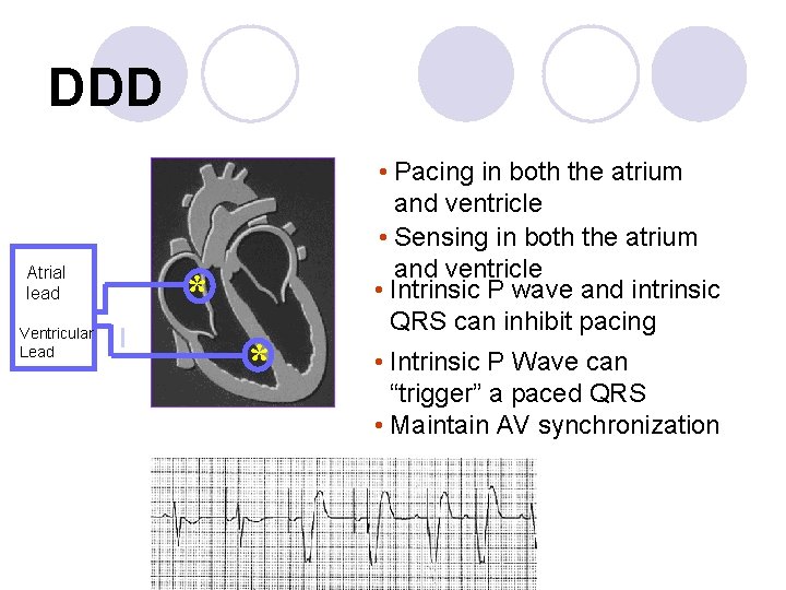 Cardiac Implantable Devices Nursing Care The Basics and