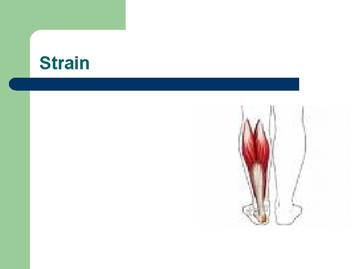 Injuries to Muscles Bones and Joints l l