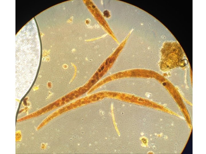 Are these worms Strongyloides Pictures from Miles Beaman